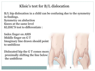 Developmental dyspalsia of hip | PPTX