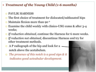 Developmental dyspalsia of hip | PPTX
