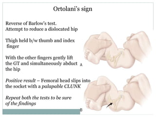 Developmental dyspalsia of hip | PPT