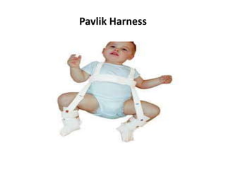 Developmental dysplasia hip | PPTX