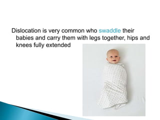 Developmental dysplasia of hip | PPTX