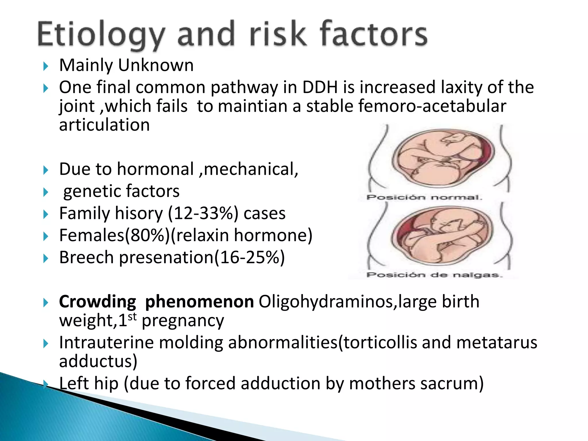 DEVELOPMENTAL DYSPLASIA OF HIP.pptx