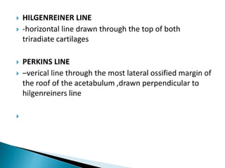 DEVELOPMENTAL DYSPLASIA OF HIP.pptx