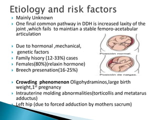 DEVELOPMENTAL DYSPLASIA OF HIP.pptx