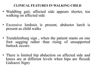 DEVELOPMENTAL DYSPLASIA OF HIP.pptx