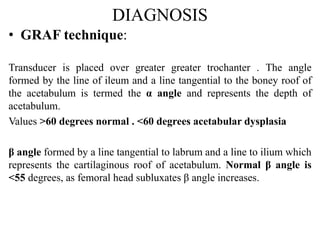 DEVELOPMENTAL DYSPLASIA OF HIP.pptx