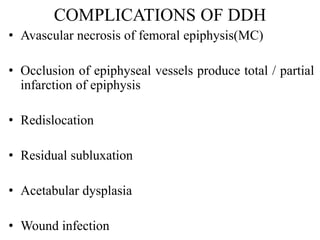 DEVELOPMENTAL DYSPLASIA OF HIP.pptx