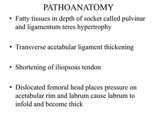 DEVELOPMENTAL DYSPLASIA OF HIP.pptx