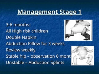 Developmental Dysplasia of hip Joint Congenital | PPT