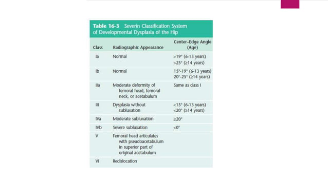 Developmental dysplasia of hip imaging | PPTX
