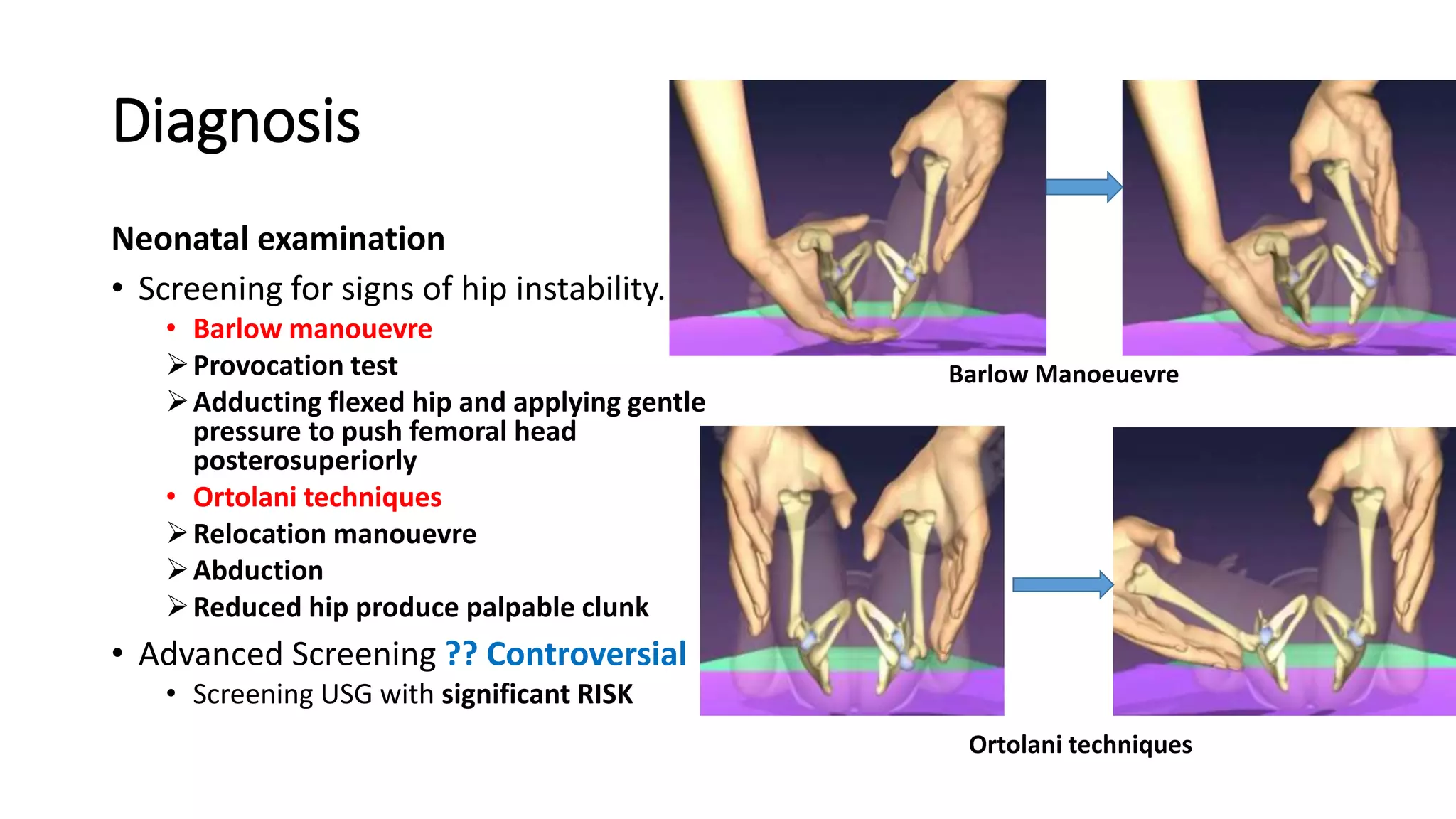 Developmental Dysplasia of Hip final.pptx