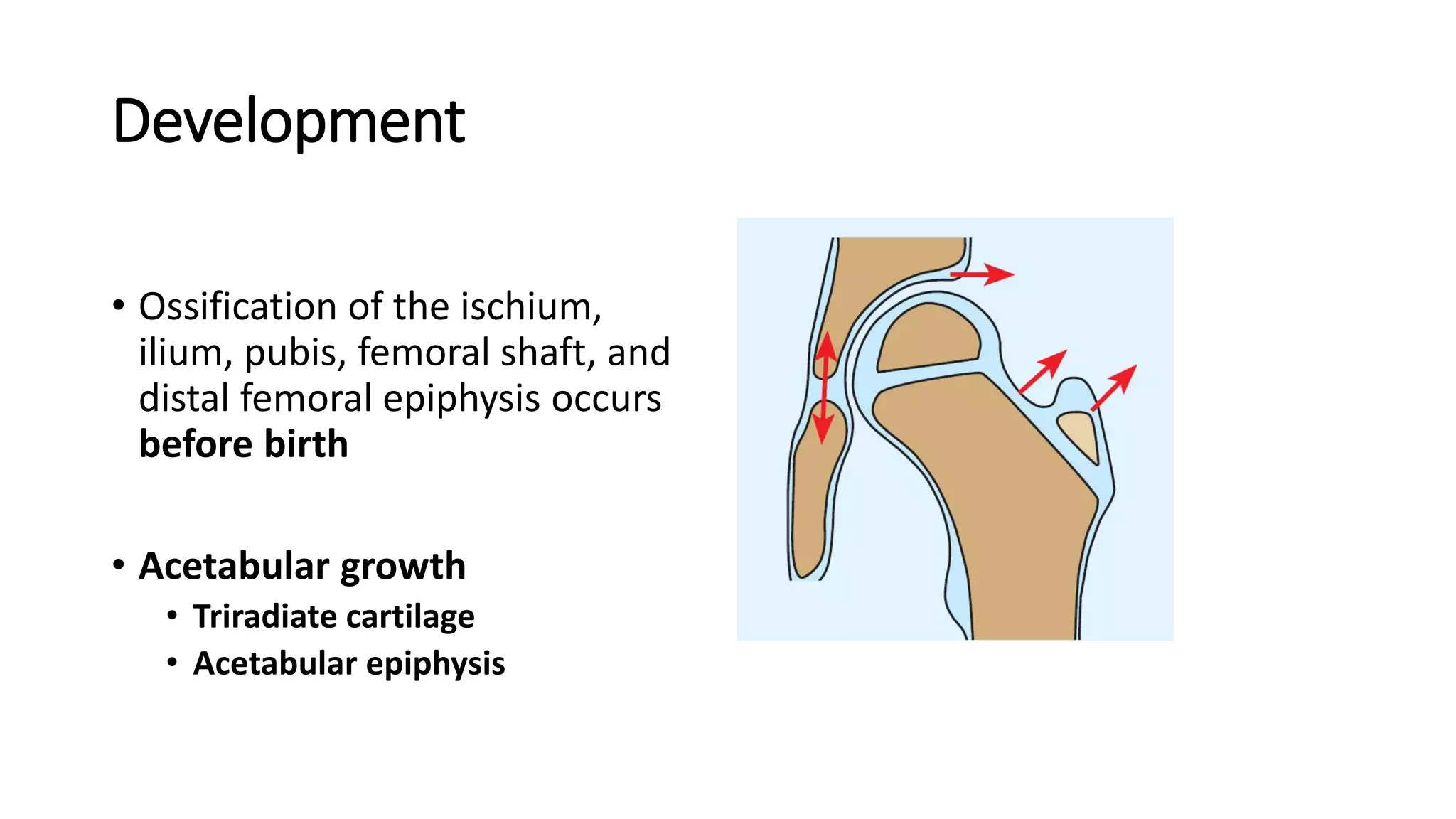 Developmental Dysplasia of Hip final.pptx