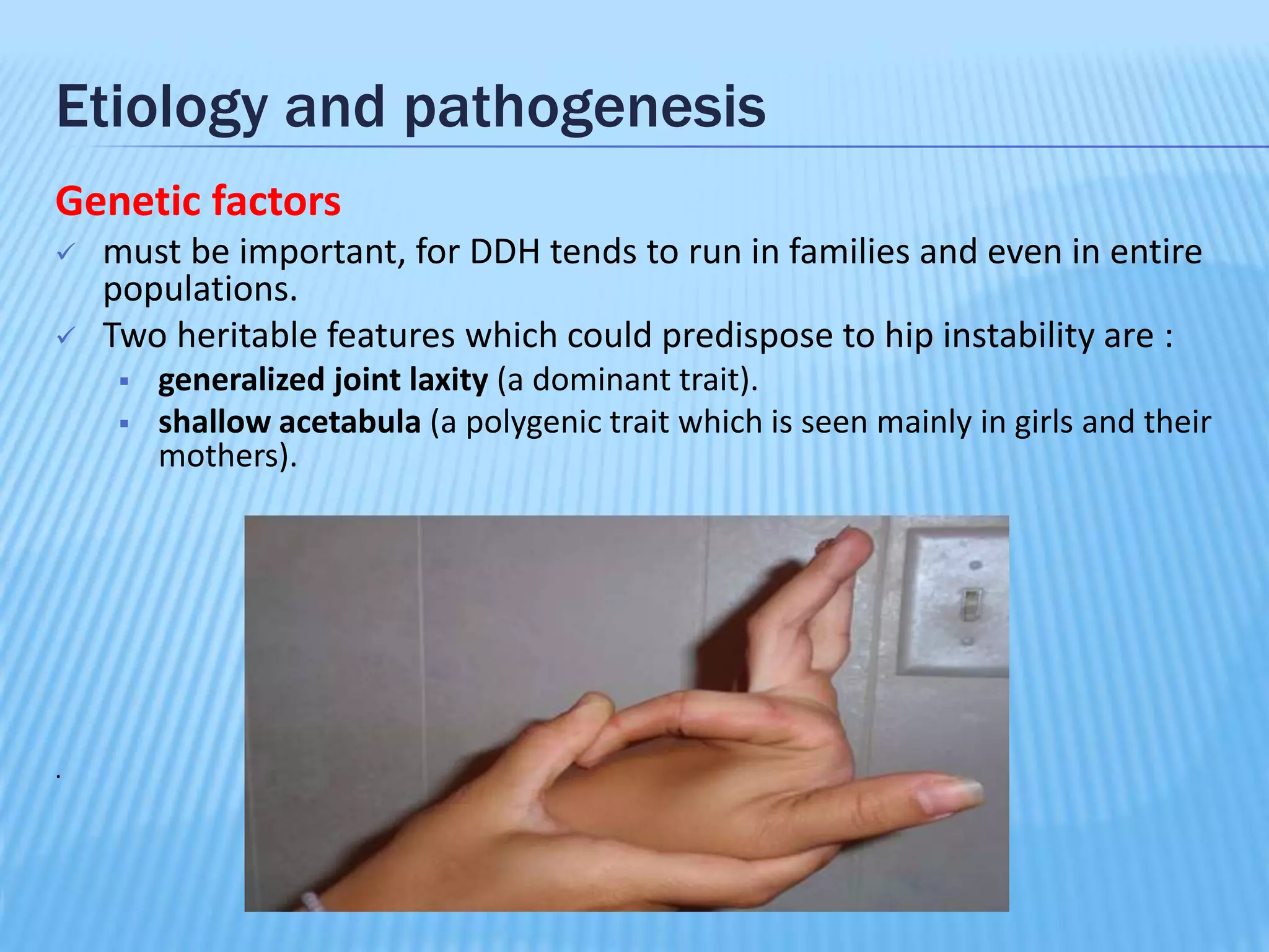 Developmental dysplasia of the hip | PPTX