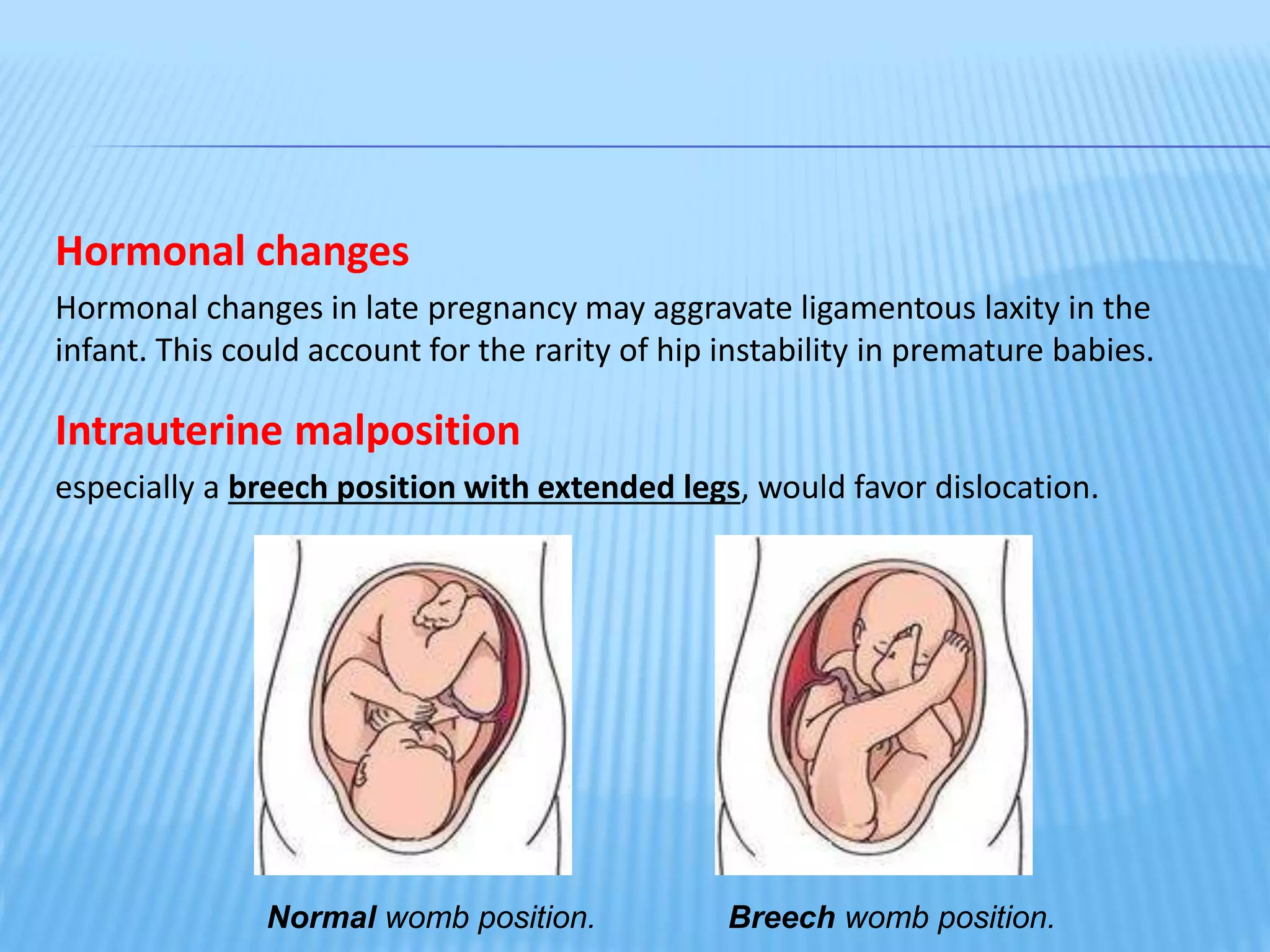 Developmental dysplasia of the hip | PPTX
