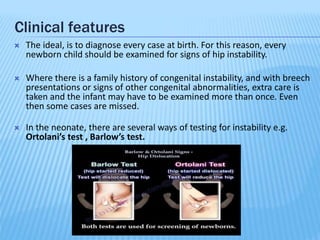 Developmental dysplasia of the hip | PPTX