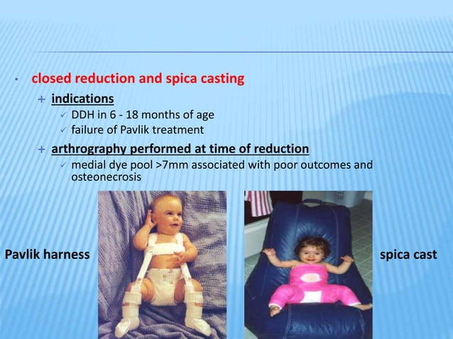 Developmental dysplasia of the hip | PPTX