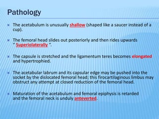 Developmental dysplasia of the hip | PPTX