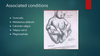 Developmental dysplasia of the hip | PPT