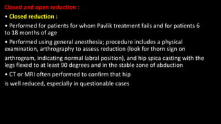 Developmental dysplasia of the hip (DDH) | PPTX