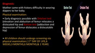 Developmental dysplasia of the hip (DDH) | PPT