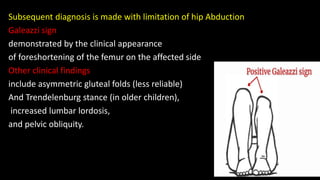 Developmental dysplasia of the hip (DDH) | PPT