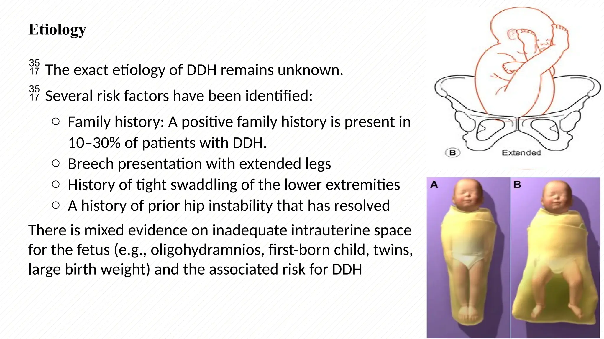 Developmental dysplasia of the hip (DDH).pptx