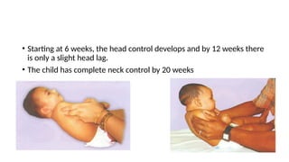 DEVELOPMENTAL MILESTONES in Children - Pediatrics | PPTX
