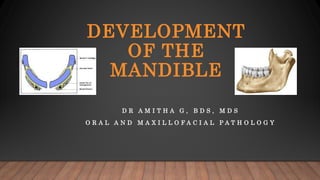 Developmental Of The Mandible | PPTX | Bone and Joint Conditions ...