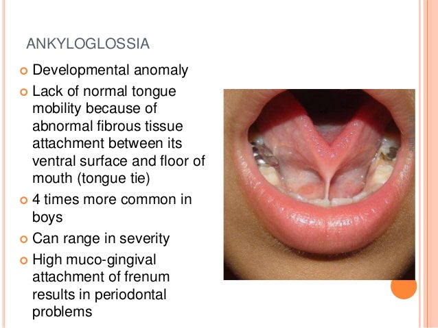 Developmental oro facial disturbances part ii