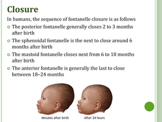 Sphenoidal Fontanelle