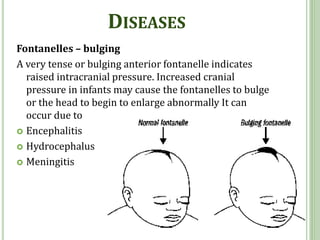 anatomy of human skull | PPTX