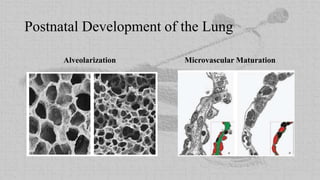 Developmental Physiology of the Respiratory System | PPT