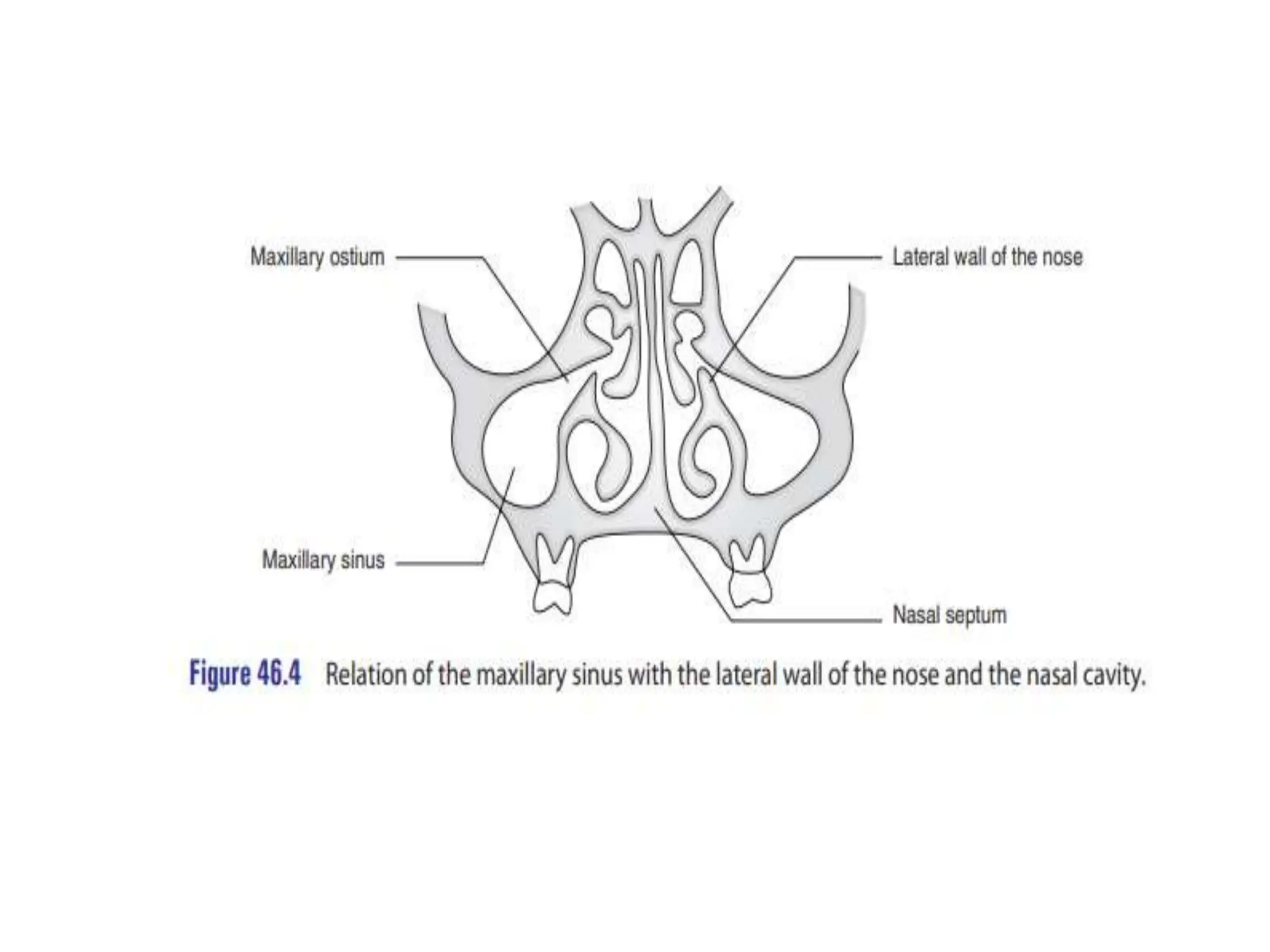Development Anatomy And Histology Of Maxillary Sinuspptx