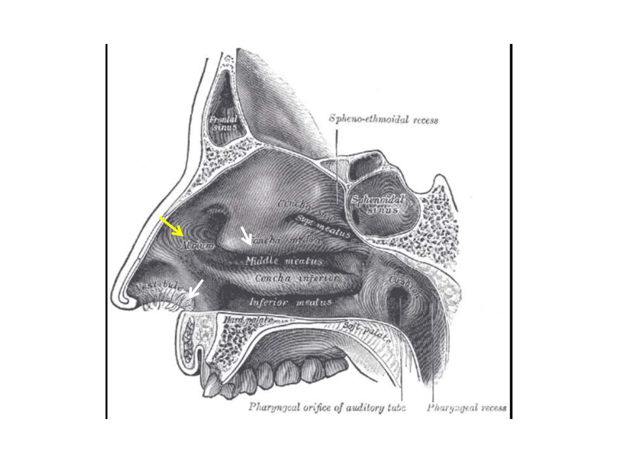 Development, Anatomy and Histology of Maxillary Sinus.pptx