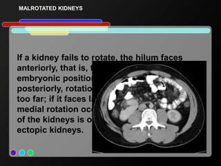 Development and congenital anomalies of urogenital system | PPTX