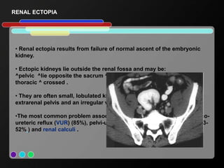 Development and congenital anomalies of urogenital system | PPTX