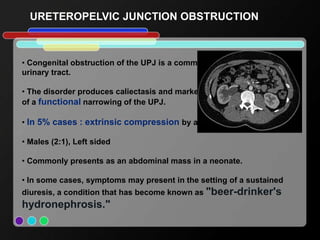 Development and congenital anomalies of urogenital system | PPTX
