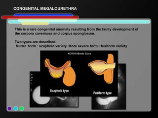 Development and congenital anomalies of urogenital system | PPTX