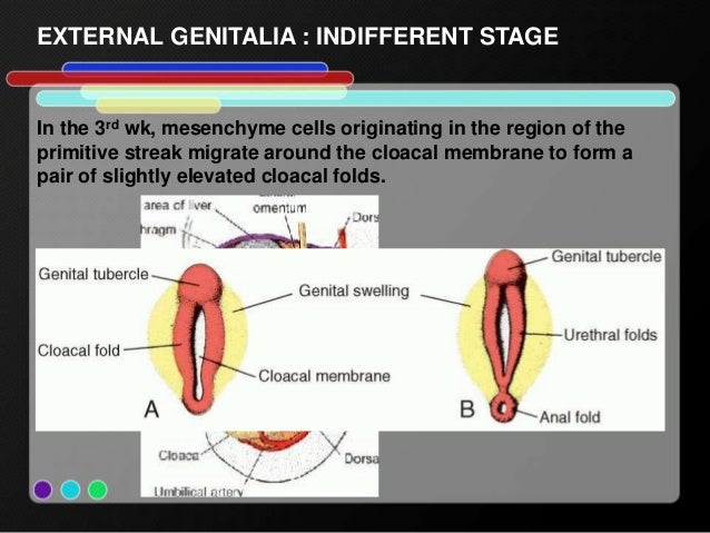 Urogenital Sinus Anomaly