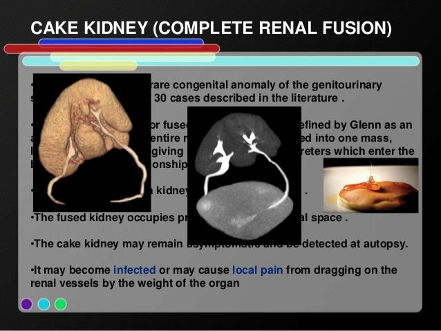 Development and congenital anomalies of urogenital system