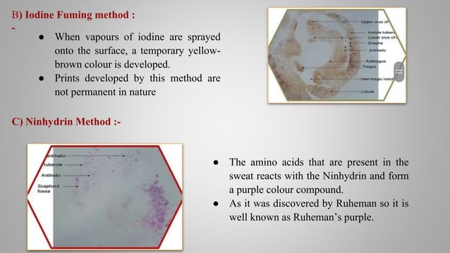 Development and lifting of Ear print.pptx | Ear, Nose and Throat ...