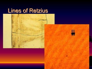 Development and morphology of primary teeth | PPT