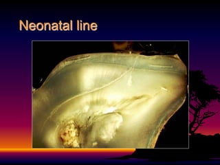 Development and morphology of primary teeth | PPT