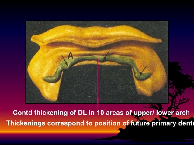 Development and morphology of primary teeth | PPT