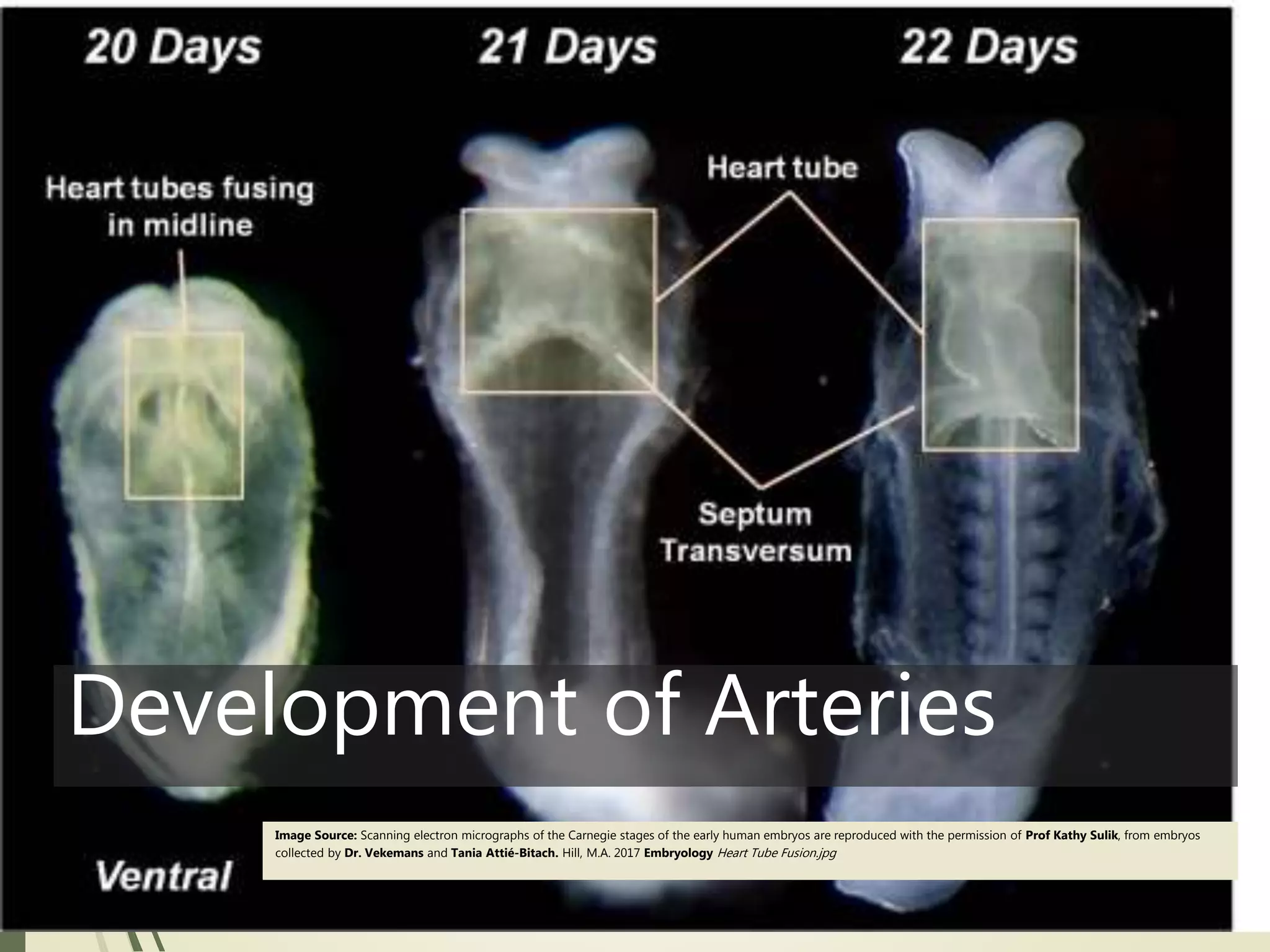 Development of Arteries | PPTX