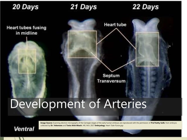 Development of Arteries | PPTX