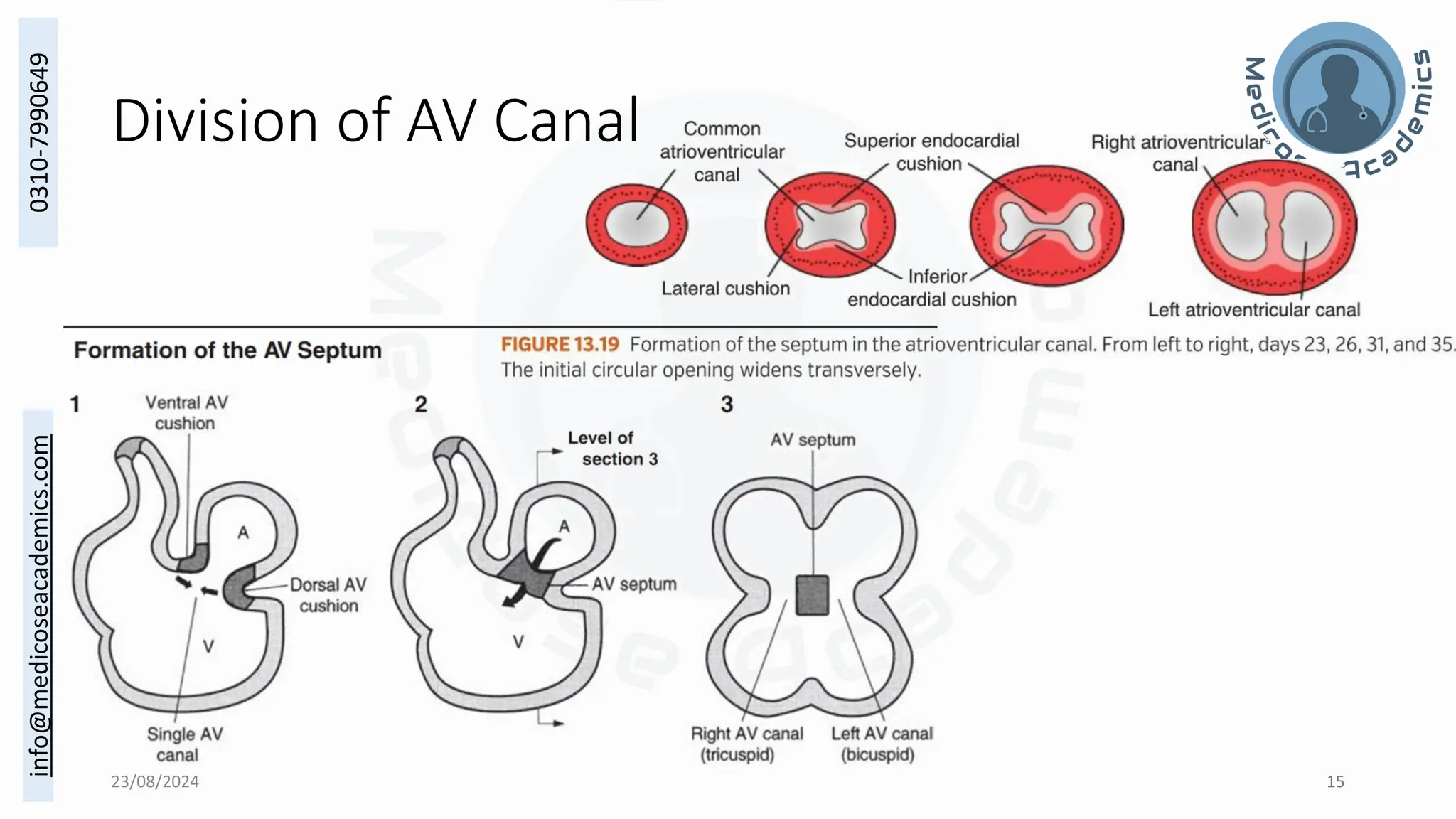 Development of Cardiovascular System.pdf