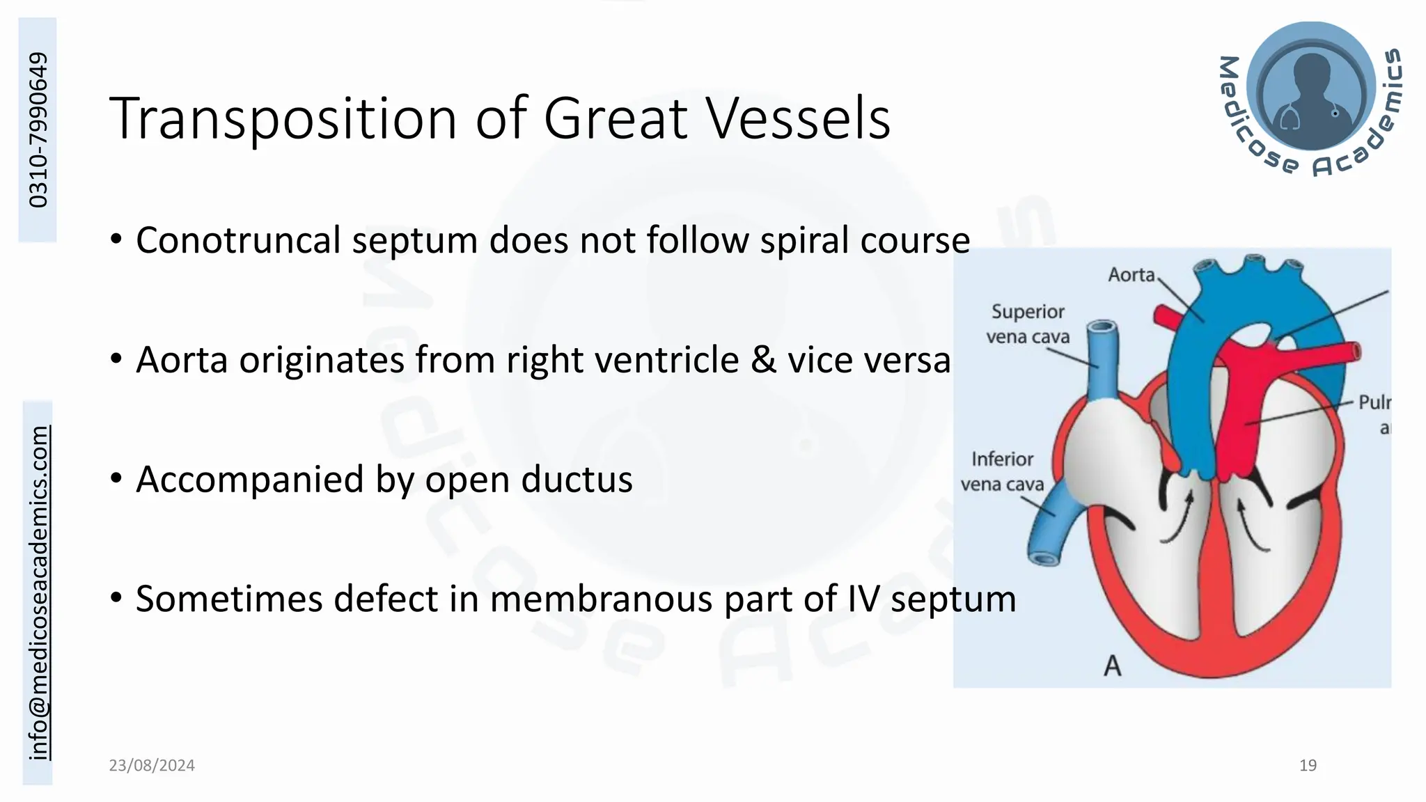 Development of Cardiovascular System.pdf