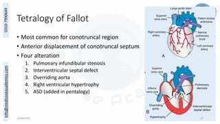Development of Cardiovascular System.pdf