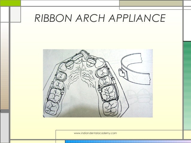 Development of contemporary fixed appliance /certified fixed orthodon…